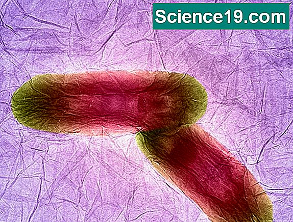 Sığır Kalbi ve İnsan Kalbi Anatomisi Nasıl Karşılaştırılır? 💫 Bilimsel ...